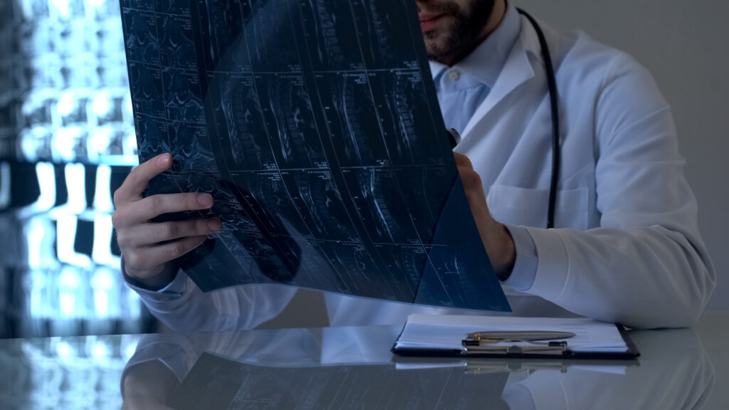 Average Settlement for Spinal Cord Injury | Apply Today